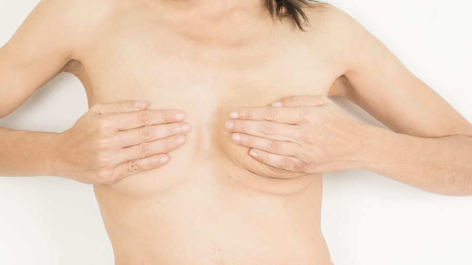 Scar Massage 101 Should I Massage My Scars Rejûvaskin