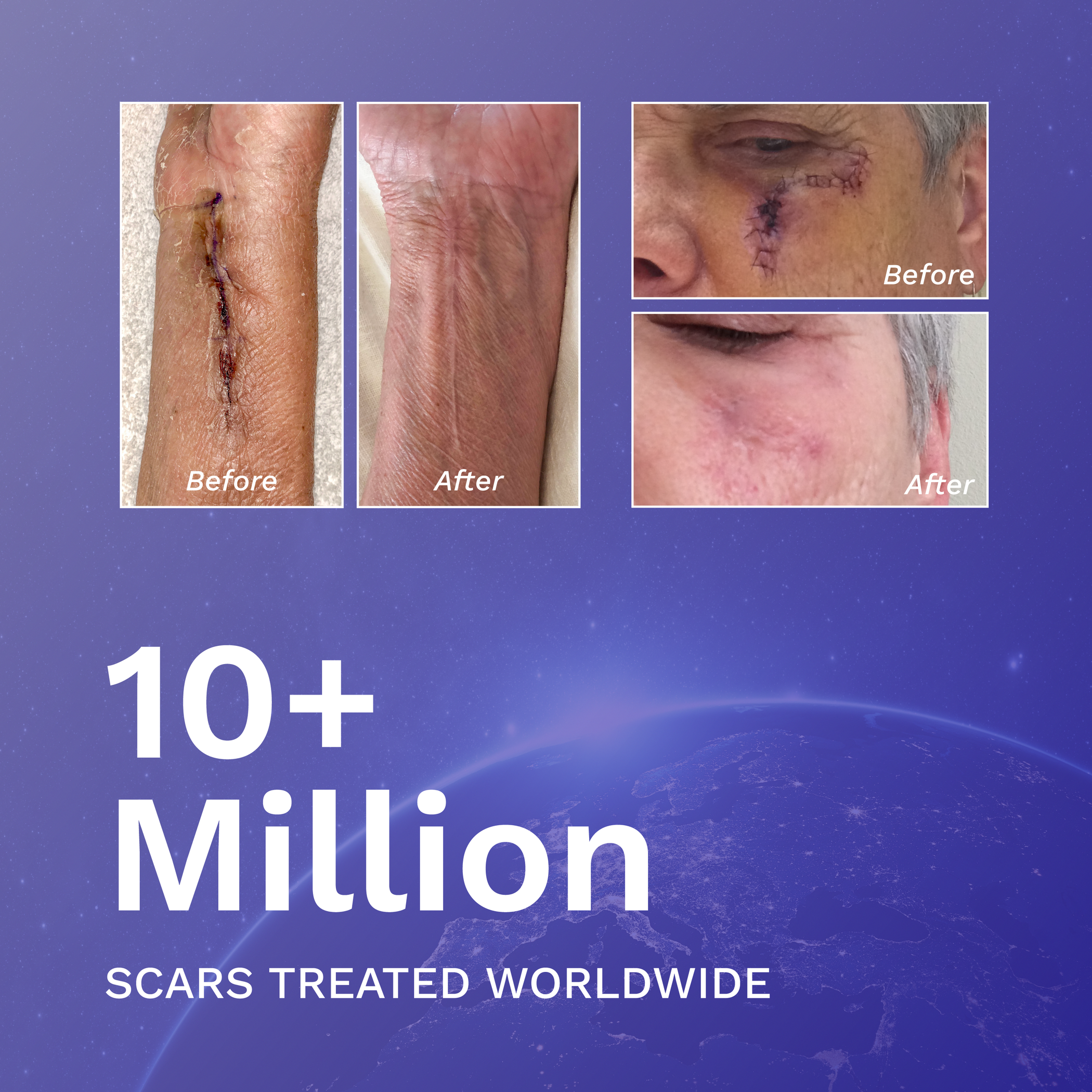 Scar Heal Kit - Prevent and Manage Surgical or Traumatic Scars – Rejûvaskin