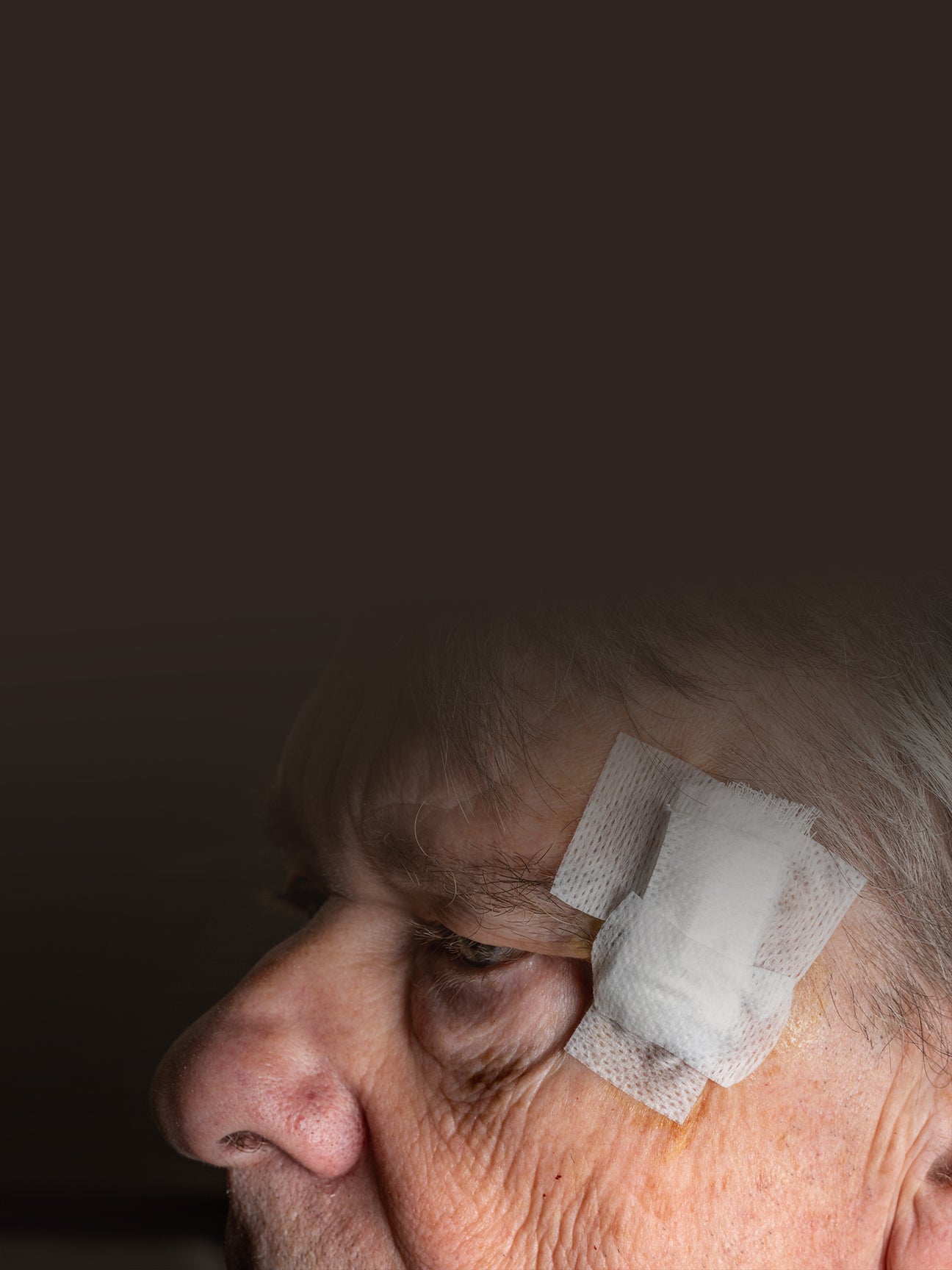 Scar Management Designed For Managing Post-Op Mohs Surgery Scars ...