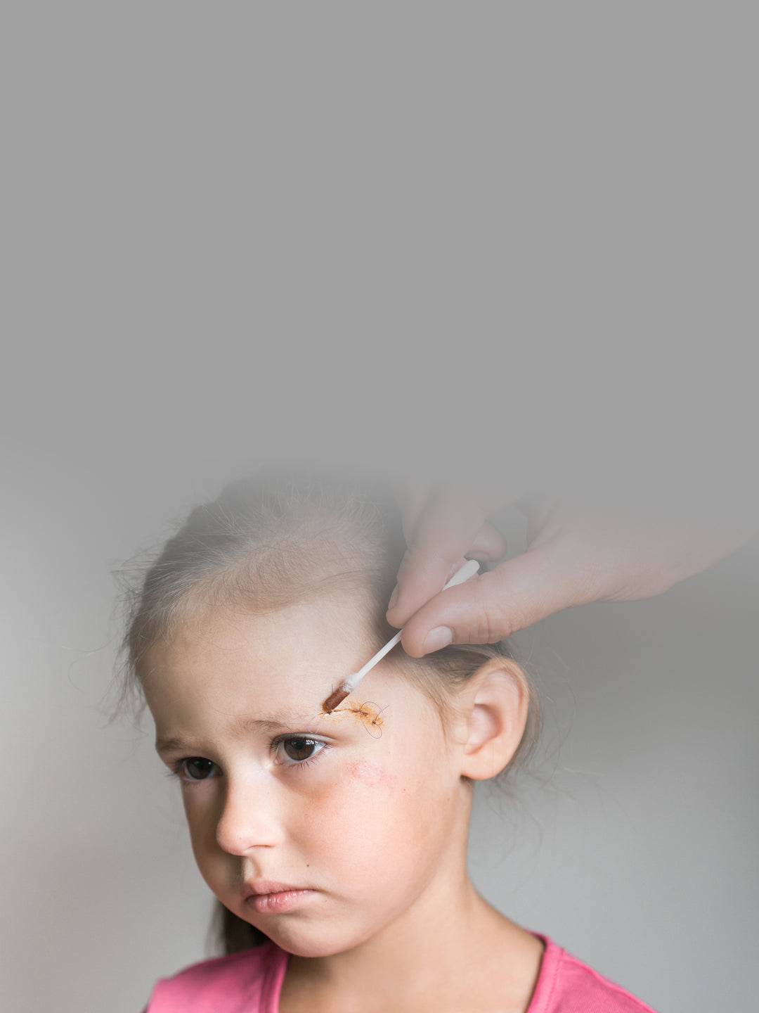 Safe, Effective Scar Management For Kids – Rejûvaskin