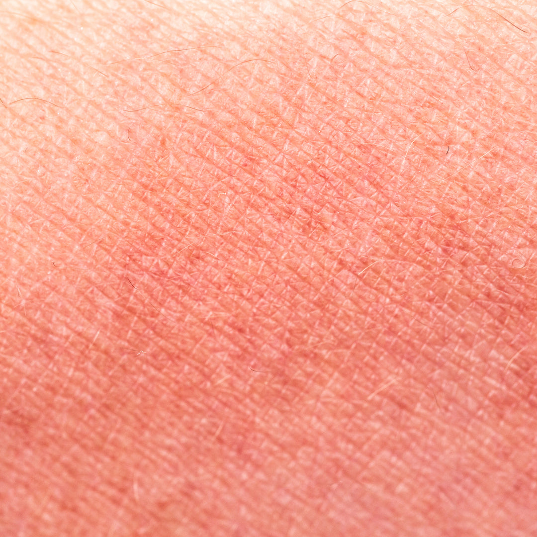 Rejuvaskin, A Skin Health Company - Recommended By Physicians – Rejûvaskin
