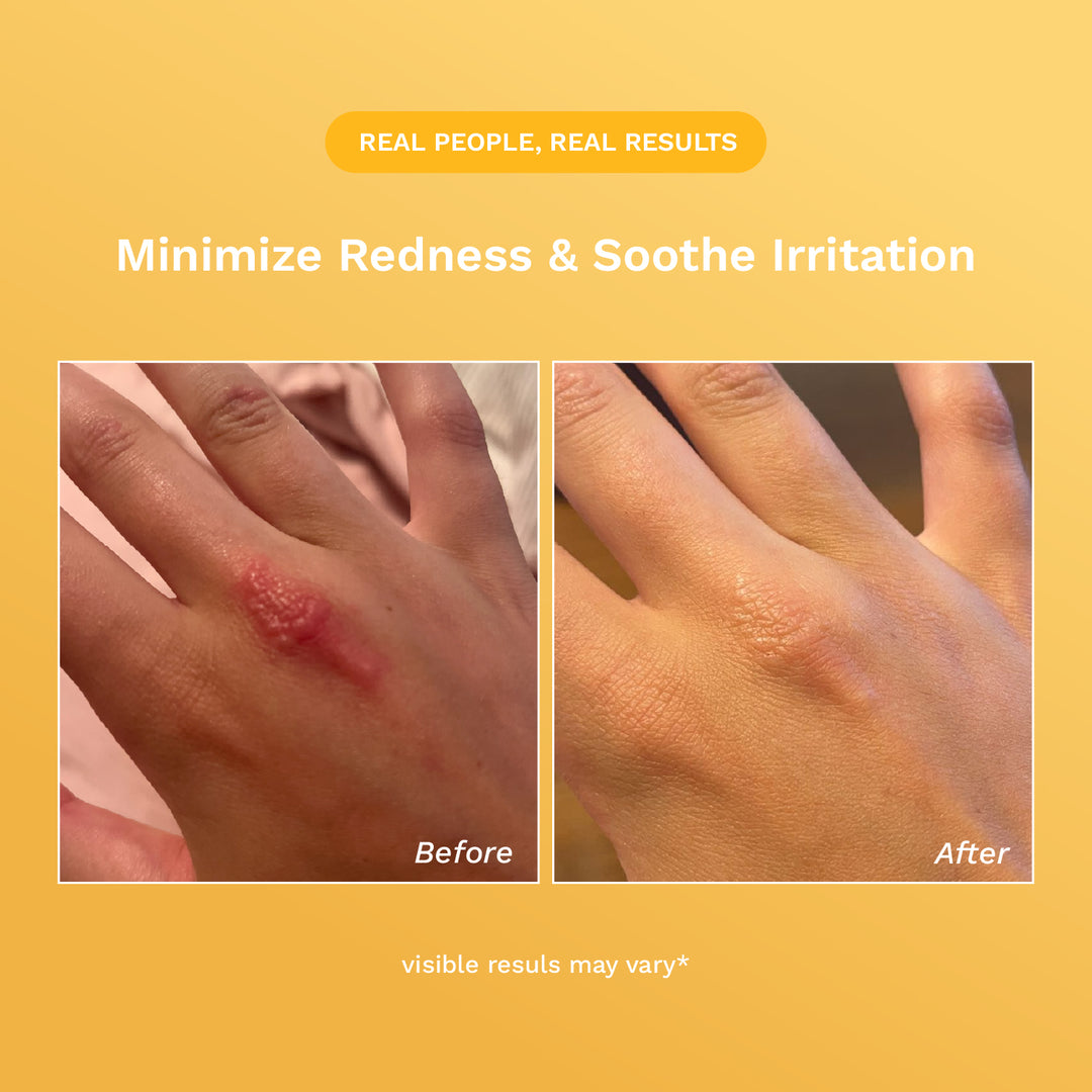 Rejuvaskin Skin Recovery Cream for Radiation Relief - Rejuvaskin ...