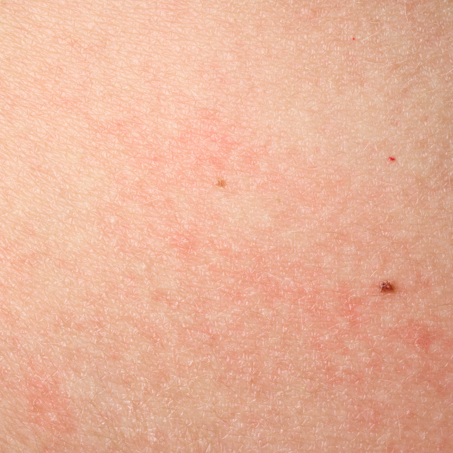 Rejuvaskin, A Skin Health Company - Recommended By Physicians – Rejûvaskin