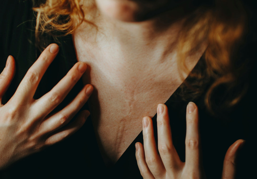 Physician Recommended, Scar Management For Open Heart Procedures ...